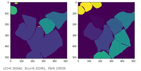 How To Set Training Parameters On My Own Datasets Cell Tracking