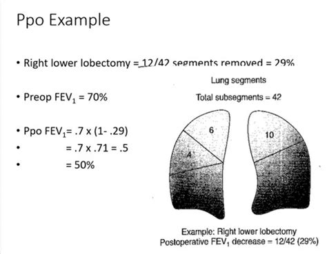 Thoracic Anesthesia Flashcards Quizlet