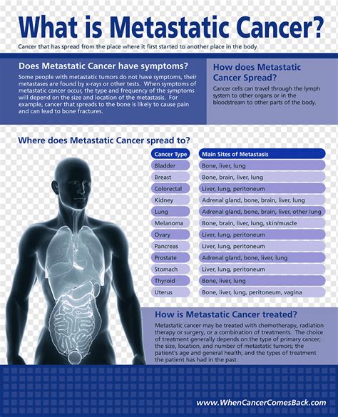 Stage Copd Life Expectancy Chart