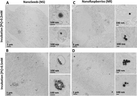 Intracellular Localization Of The Nanoparticles Transmission Electron
