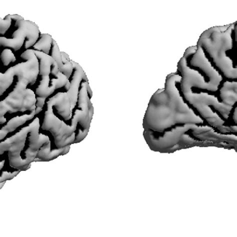 Graph Cut Segmentation Results A Lateral View B Medial View