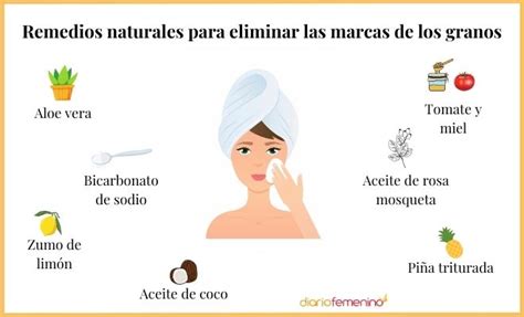 Manchas Y Cicatrices Por Los Granos Cómo Eliminar Las Marcas Del Acné
