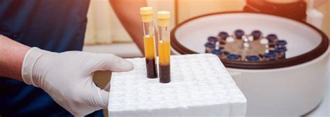 Prp Joint Injection San Diego Oasis Health And Medicine 858 201 3171