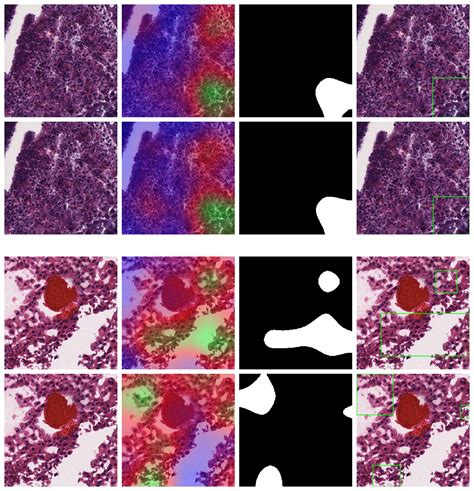 Github Piyush Exploring Histological Similarities Across Cancers From A Deep Learning