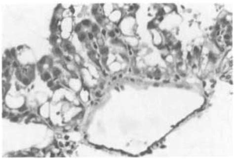 Plate 4 Choroid Plexus In The Brain Of A Female A Mouse Treated With