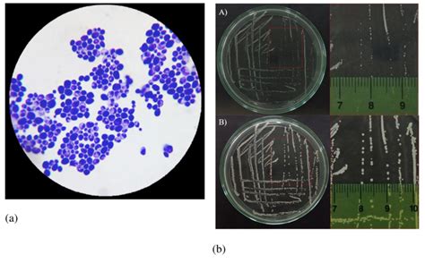 Morphology Of Candida Albicans A Microscopic Morphology Of Candida Download Scientific