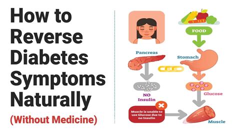 How To Reverse Diabetes Symptoms Naturally Without Medicine