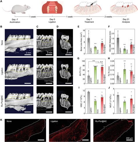 Periodontitis Treatment Assessment Of Ru‐por‐net‐based Antioxidase‐like