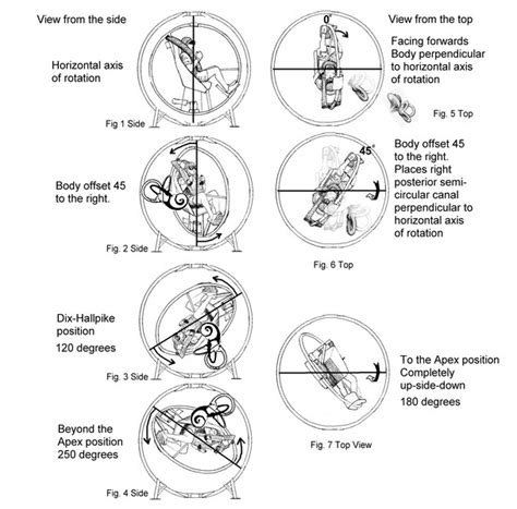 Epley Maneuver Canalith Repositioning Procedure Treatment Of Bppv
