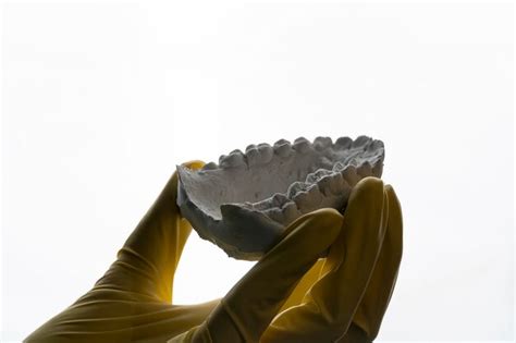 Premium Photo Showing The Patient A Plaster Mouth Taken From An