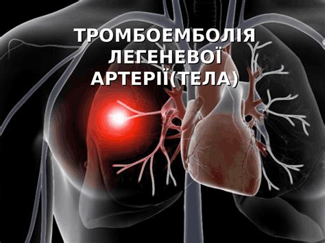 Презентація ТЕЛА хірургія Презентации Хирургия Docsity