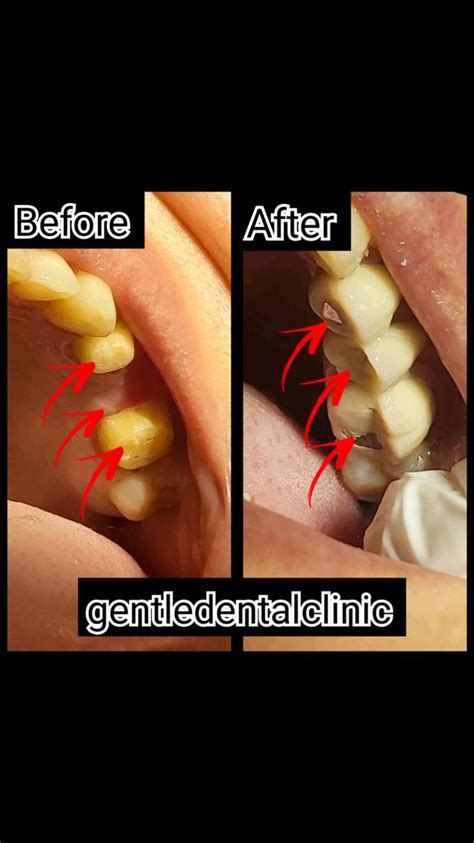 Pin By Vanessa Nieto On Fotografia Mirror Selfie Selfie Scenes