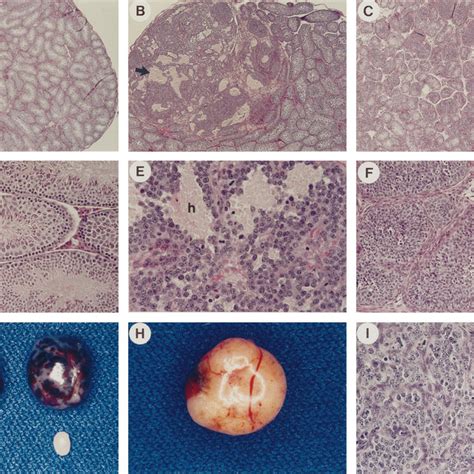 Gross And Histological Analysis Of The Testes And Testicular Tumors