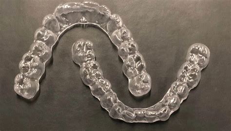 Thermoformed Vs 3d Printed Aligners