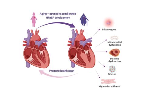 Acc Expert Consensus On Management Of Hfpef Key Points Cardio Blogger