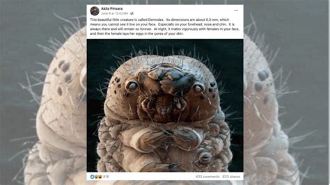 Real Pic Of Demodex Mites That Live On Human Faces