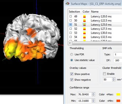 eeg meg source imaging and analysis