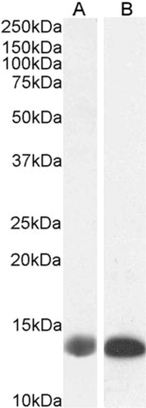 Fabp1 Polyclonal Antibody Pa5 143300