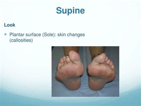 Ppt Foot And Ankle Examination Powerpoint Presentation Free Download