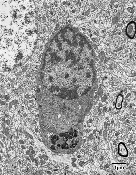 Chapter 12 Oligodendrocytes Fine Structure Of The Aging Brain Boston University
