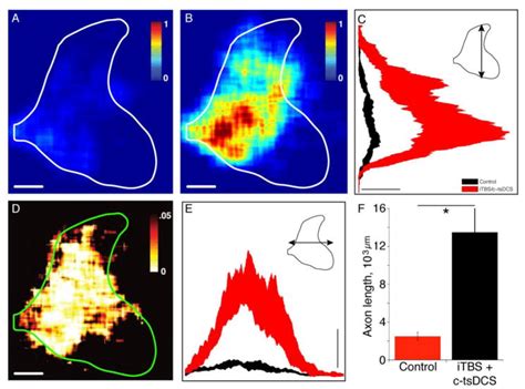 Combined Motor Cortex And Spinal Cord Neuromodulation Promotes