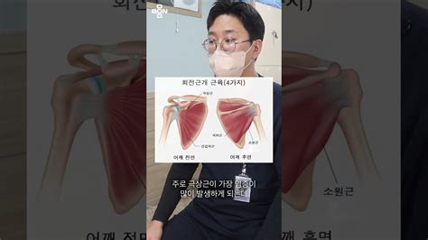 팔을 옆으로 들어올릴 때 통증이 발생하는 질환 어깨충돌증후군 Youtube