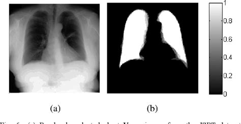 Figure 1 From Lung Segmentation In Chest Radiographs Using Anatomical Atlases With Nonrigid