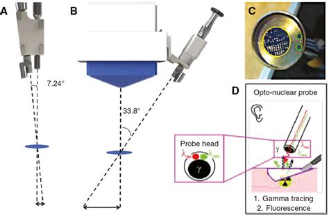 Dual Modal Imaging Devices Composed Of A Gamma Probe Camera And A Download Scientific Diagram