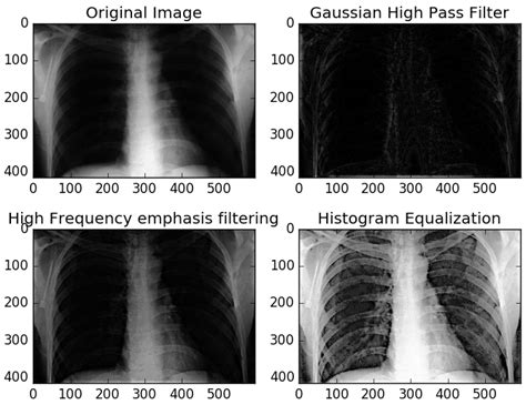 Pdf Télécharger Fir High Pass Filter Python Gratuit Pdf