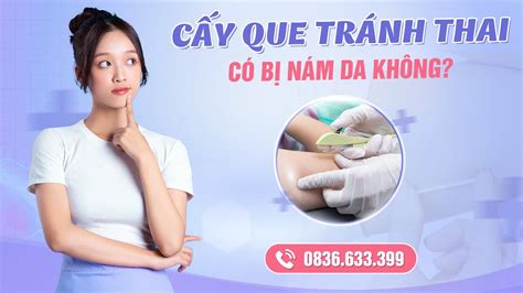 Cấy Que Tránh Thai Có Bị Nám Da Không Hiểu Biết Sức Khỏe Và Lựa Chọn
