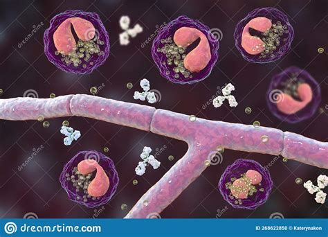 Splendore Hoeppli Phenomenon 3d Illustration Eosinophilic Reaction