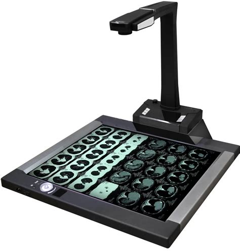 Joyusing Ct160 X Ray Film Scanner For Hospital And Clinic Diagnosis