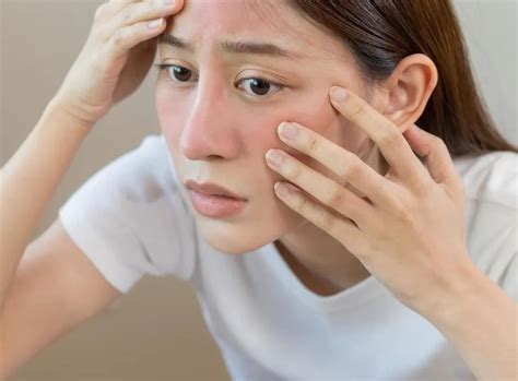 Ayurvedic Treatment Of Cosmetic Allergy Causes Symptoms And More