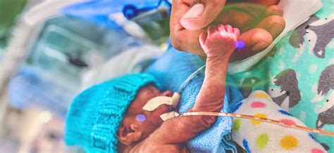 Hca Healthcares Nicu Teams Deliver Lifesaving Care For Babies Born
