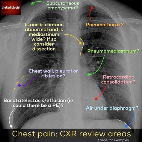 Pin On Radiology Anatomy