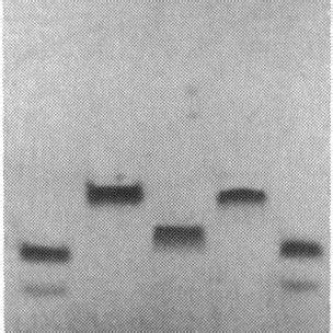 PAGE Acrylamide M Urea Gel Buffer MM Tris Borate MM Download Scientific Diagram