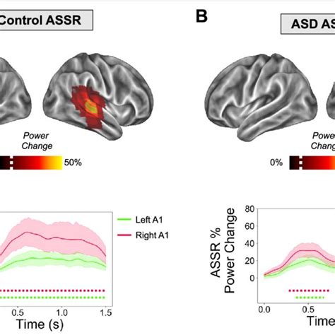 Assr Power Analysis Top Panels A B Assr Beamformer Localization Download Scientific