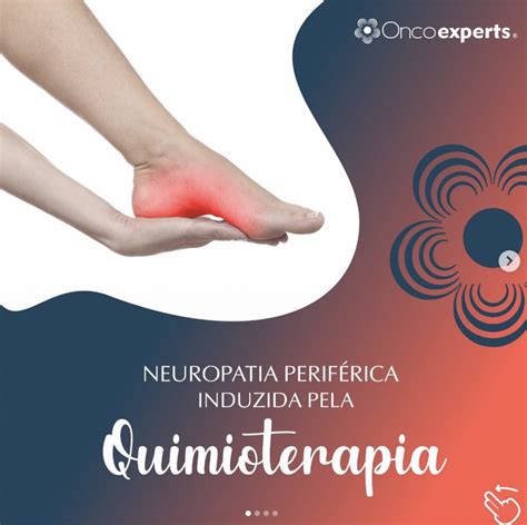 Já ouviu falar sobre neuropatia periférica induzida pela quimioterapia
