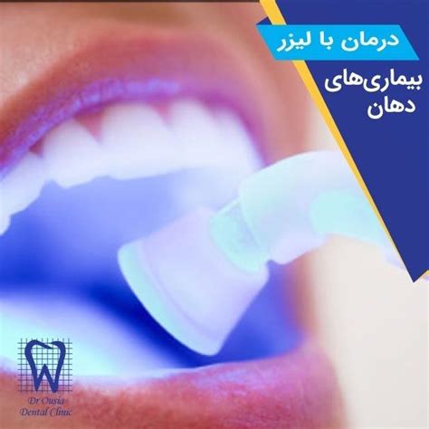 امروزه با ورود لیزر به حوزه های درمانی به خصوص دندانپزشکی انقلابی عظیم به پا شده است با ورود