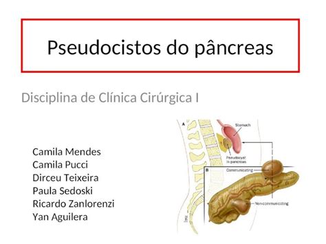 PPT Pseudocistos do pâncreas Disciplina de Clínica Cirúrgica I Camila Mendes Camila Pucci