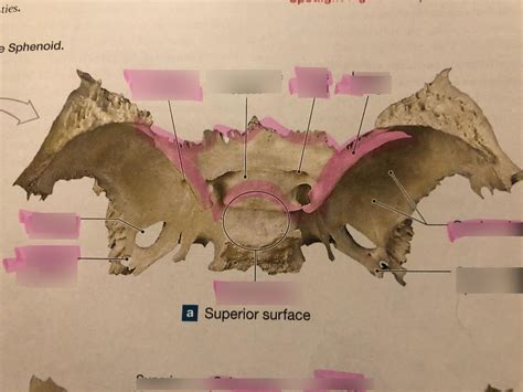Sphenoid Superior Diagram Quizlet