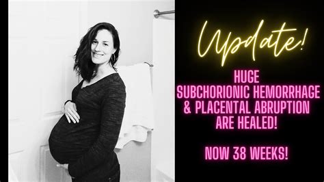 38 Weeks Huge Subchorionic Hemorrhage And Chronic Placental Abruption