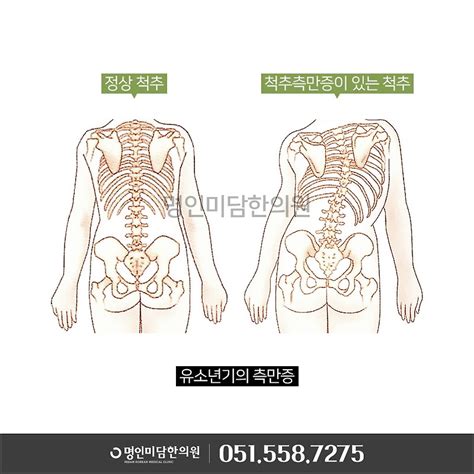 수안동 야간 진료로 부산 허리 협착증 치료 한방에 해결