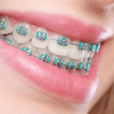 Cum On My Braces Cumonmybraces X