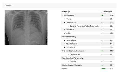 Diagnostic Medical Errors Are A Huge Problem Will Ai Come To The Rescue