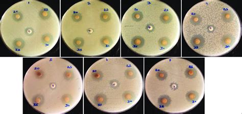 The Antibacterial Activity Of Silver Nps Using Indigofera Cordifolia