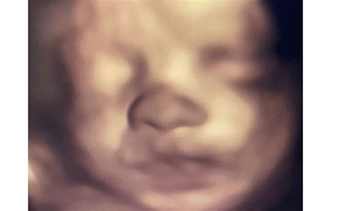 3d Ultrasound By Sneak A Peek 4d Ultrasounds In Fenton Mo Alignable
