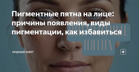 Пигментные пятна на лице причины появления виды пигментации как