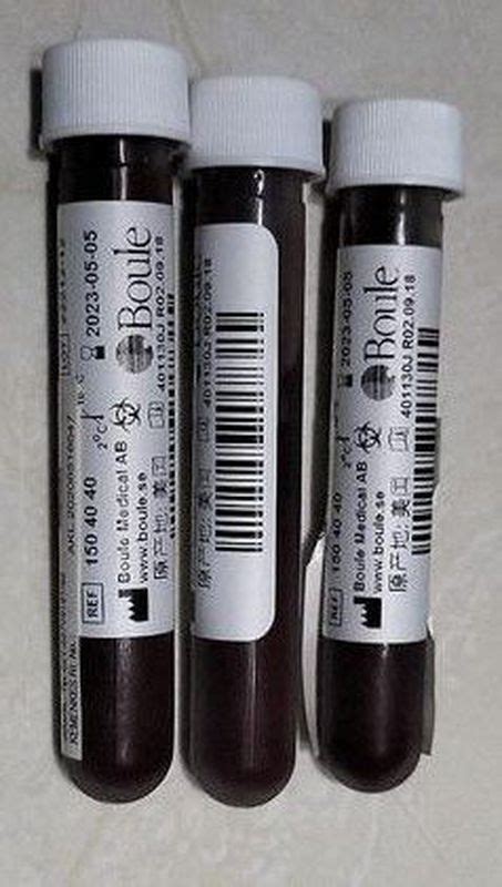 Control Diff Normal 16 Param 1 X4 5 Ml