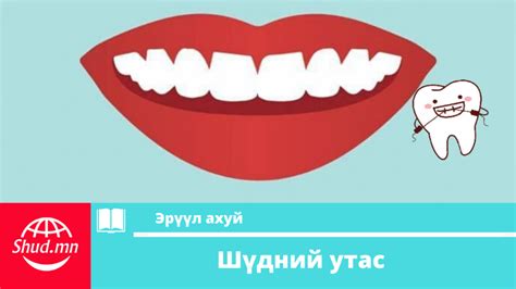 Шүдний утас